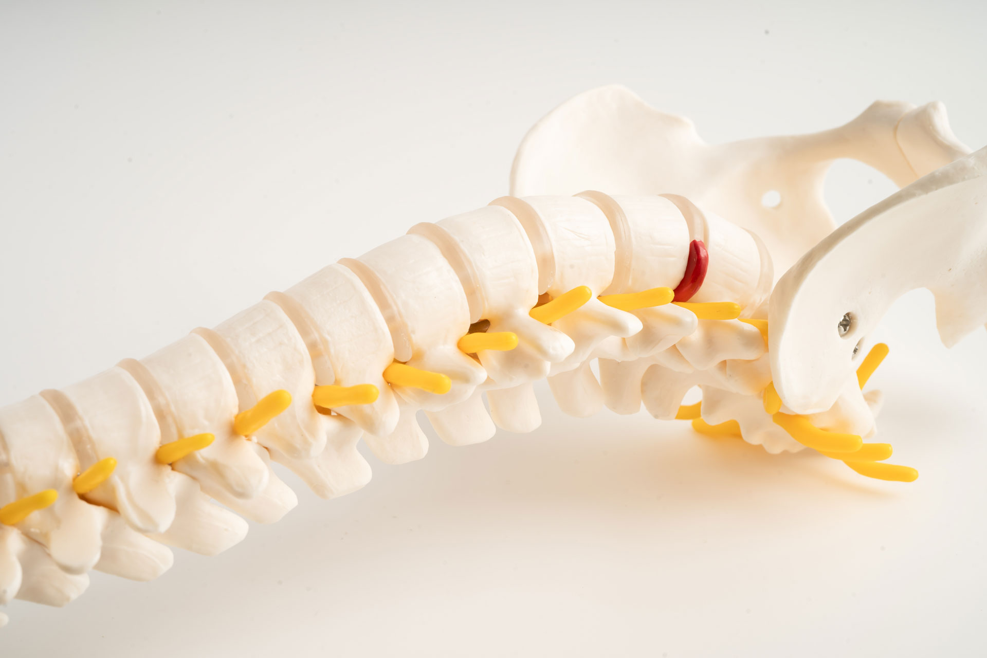 Using Spinal Traction to Address Herniated Discs and Pain - Benson ...